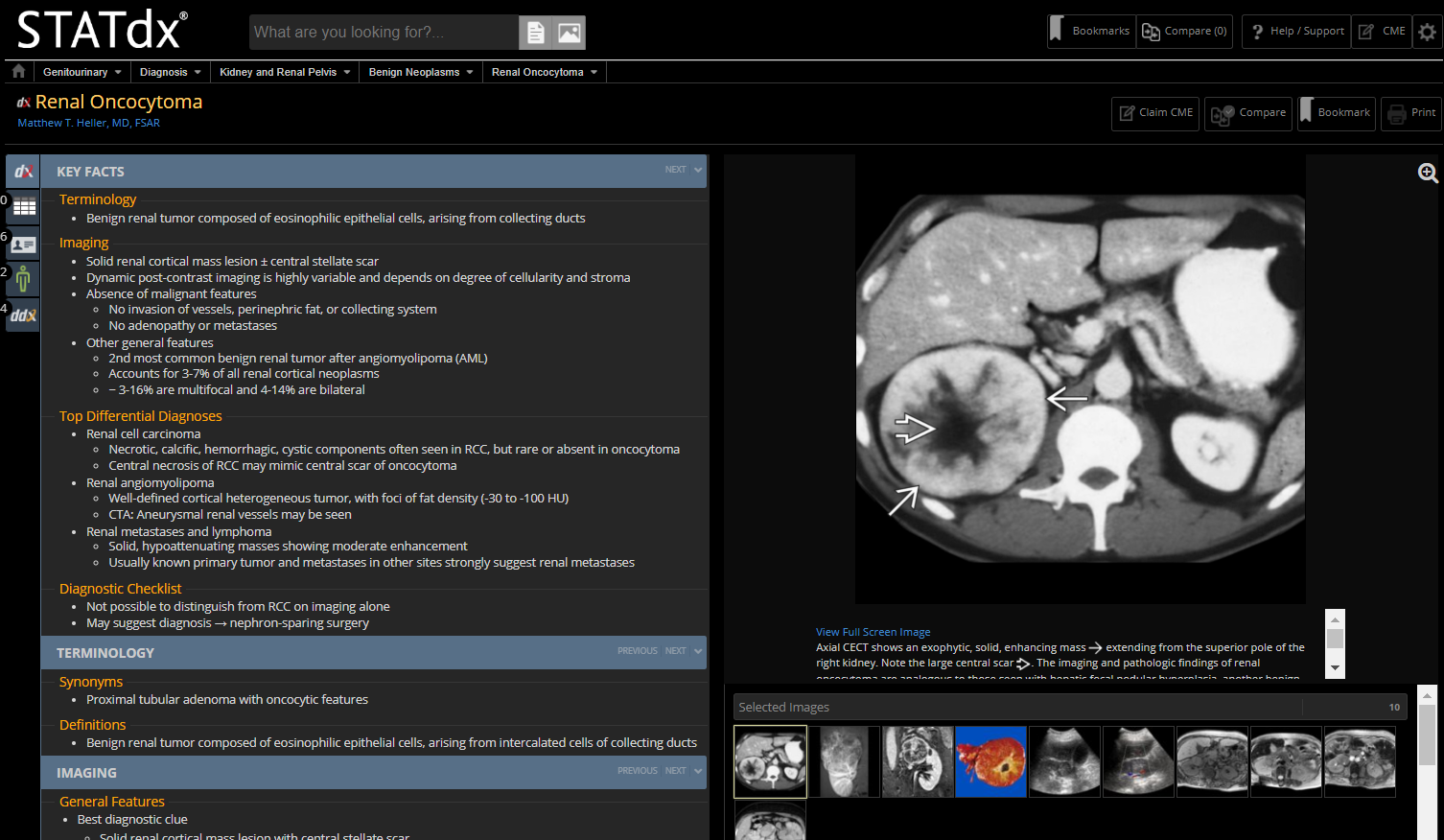 STATdx – subskrypcja dla aktywnych członków PLTR | Polskie Lekarskie ...