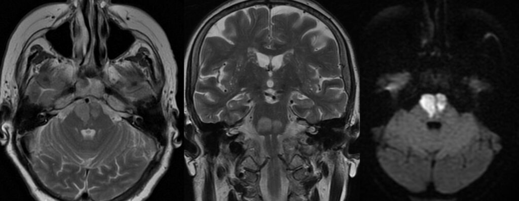 Polskie Lekarskie Towarzystwo Radiologiczne | Radiologia w Polsce